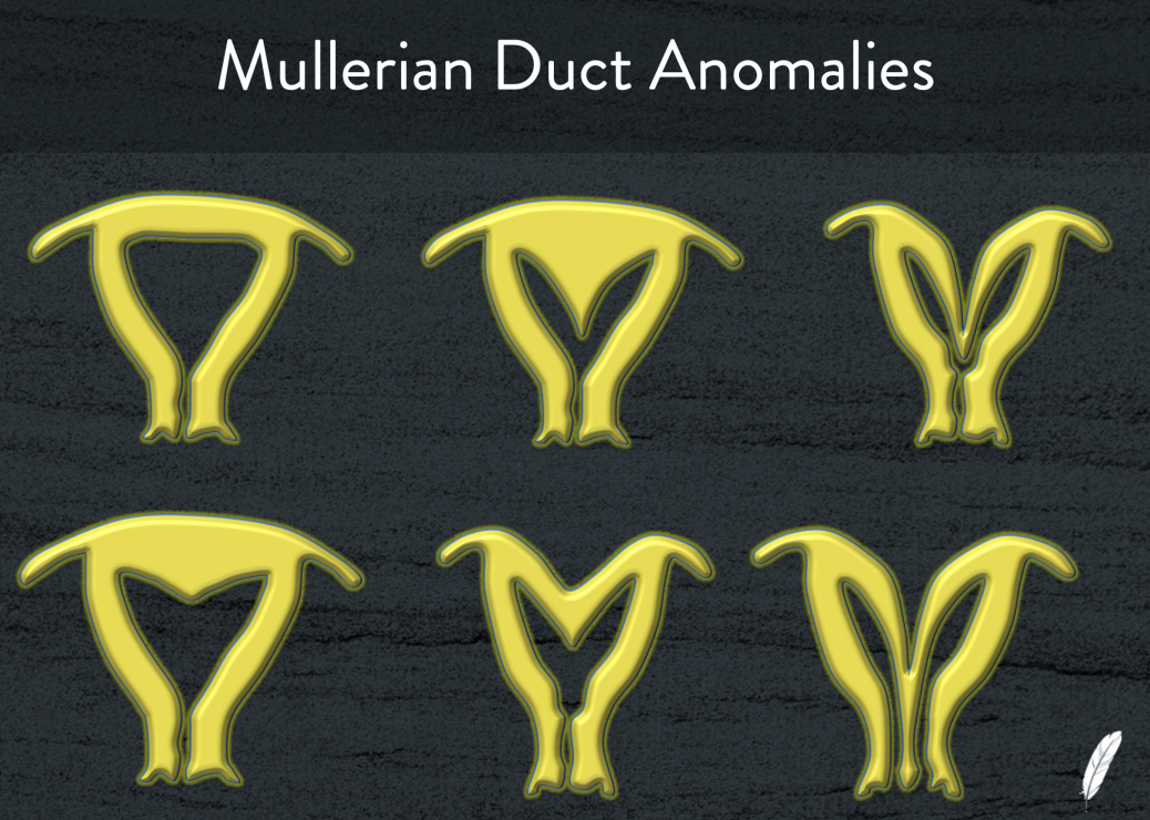 Mullerian Duct – Bird Ultrasound